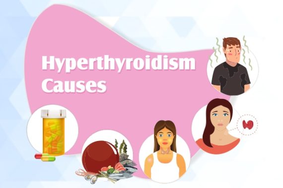 Hyperthyroidism Causes & Symptoms – Tests & Treatment