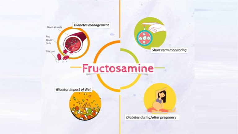 Fructosamine Test – Purpose, Procedure, and Result Meaning