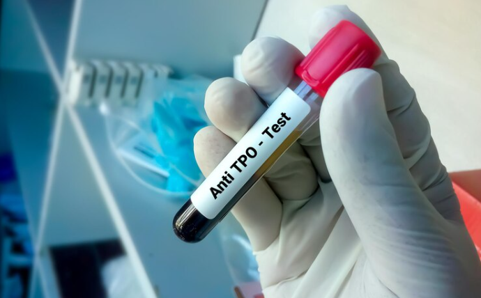 Anti Microsomal Antibody (AMA) Test | Autoimmune Thyroid Test